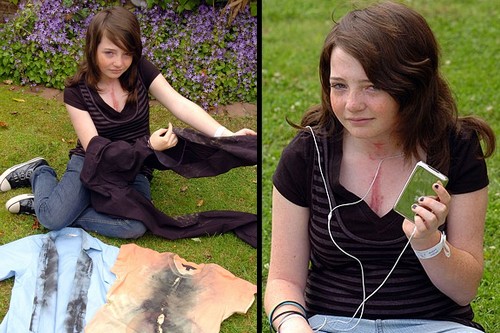 10 People who were struck by lightning and survived - Wonderslist